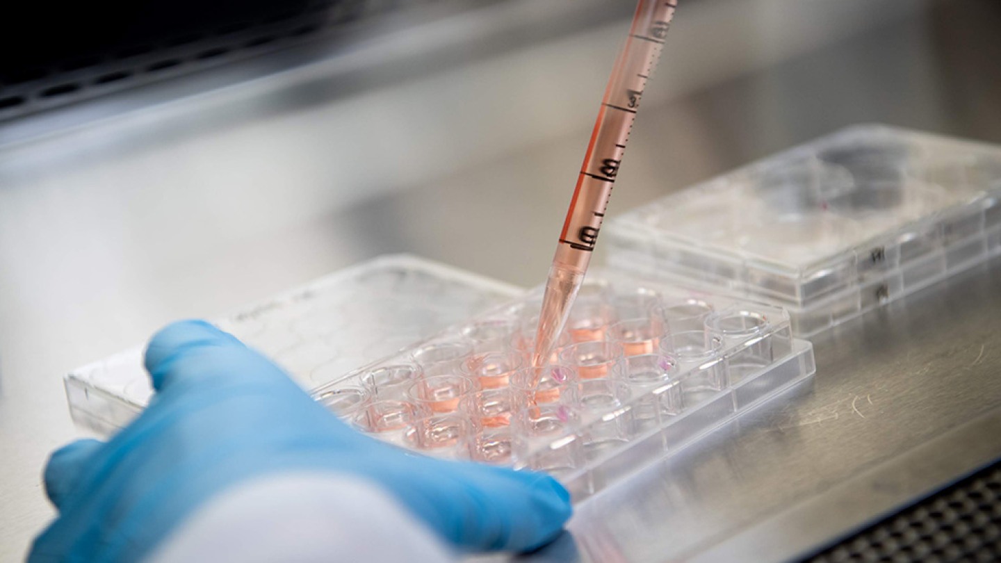 Brown funds three biomedical engineering technologies with potential to ...