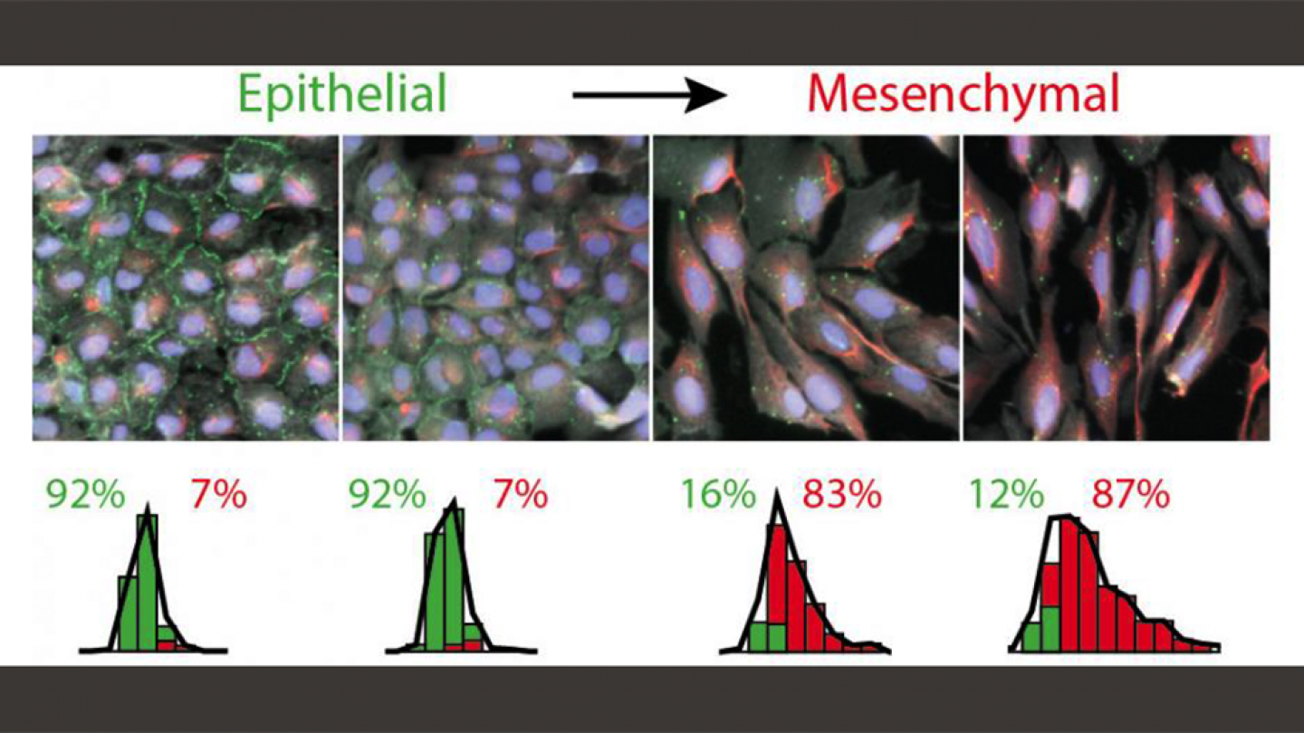 Machine learning technique helps identify cancer cell types ...